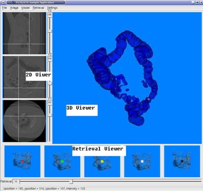 Colon Volume Retrieval Using Curvature Analysis